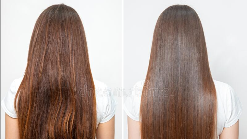 How Can I Get My Hair Transformed? | HealthTrip | HealthTrip