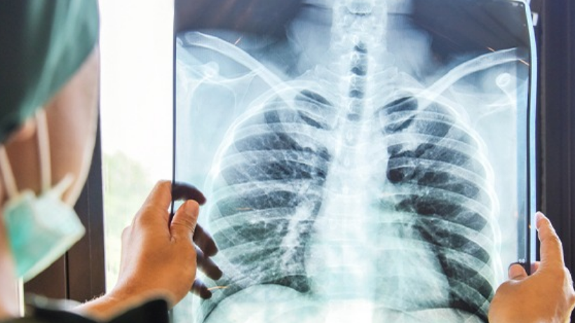 How To Detect Cancer - A Small Guide To Check Cancer | HealthTrip ...