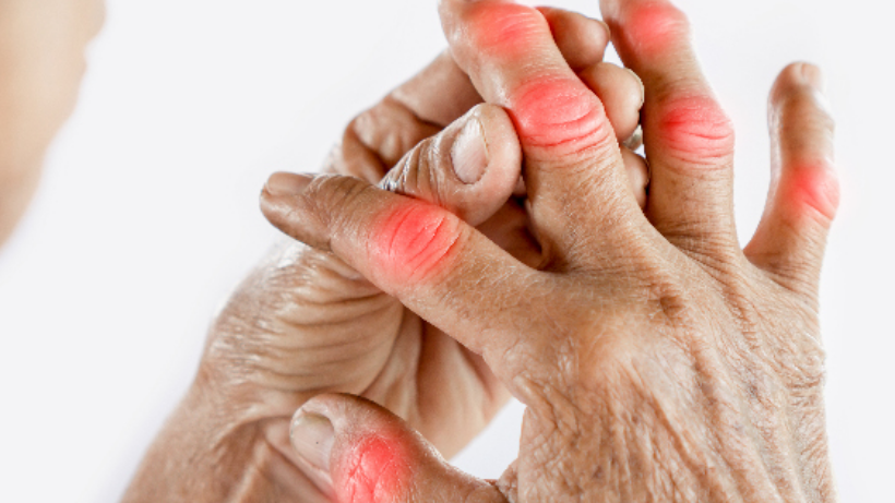 Arthritis Treatments, Symptoms, Causes & Types | HealthTrip | HealthTrip