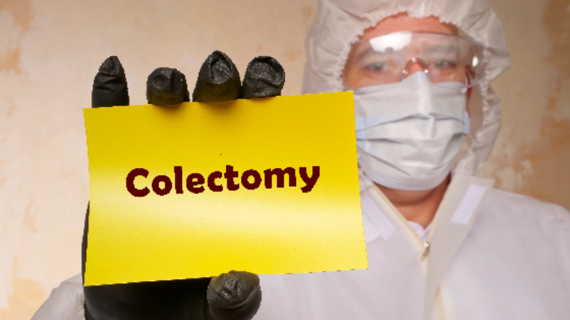 Colectomy - 8 Things You Should Know | HealthTrip | HealthTrip
