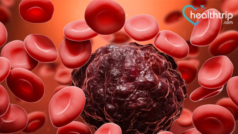 12 Signs of Blood Cancer - Blood cancer symptoms | HealthTrip | HealthTrip