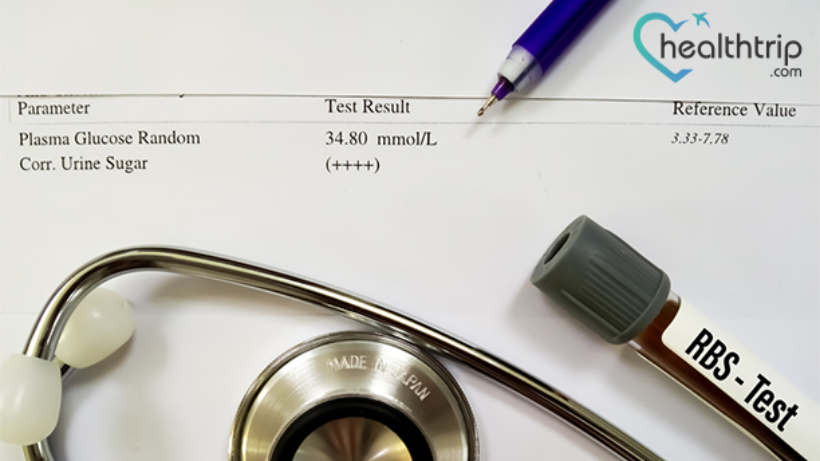 Random Blood Sugar - RBS Test | HealthTrip | HealthTrip