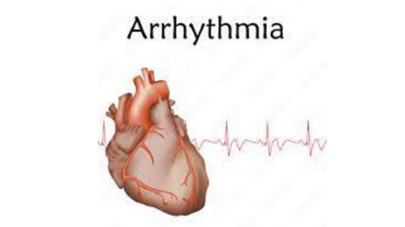 ?Arrhythmias፡- ከማወቅ ወደ ከፍተኛ ሕክምና
