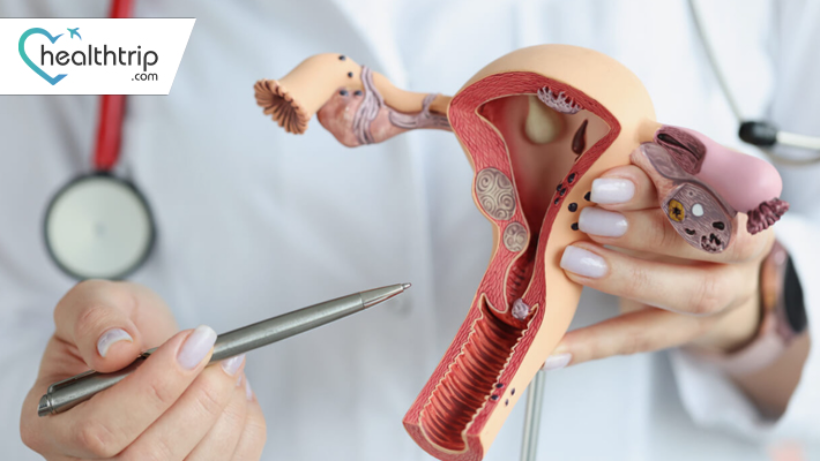 Peringkat Kanser Ovari: Apa yang Anda Perlu Tahu