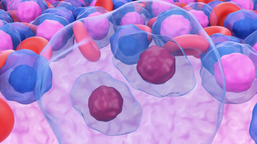 Hodgkin's disease?: From cause to prevention | HealthTrip