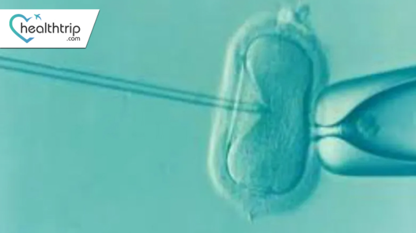 Prosedur GIFT dan ZIFT : Transfer Gamet dan Zigot Intrafallopian ...